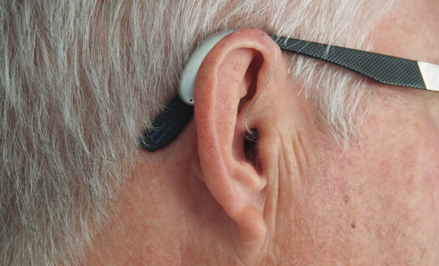 Understanding the 4 Stages of Meniere’s Disease and the Nervous System